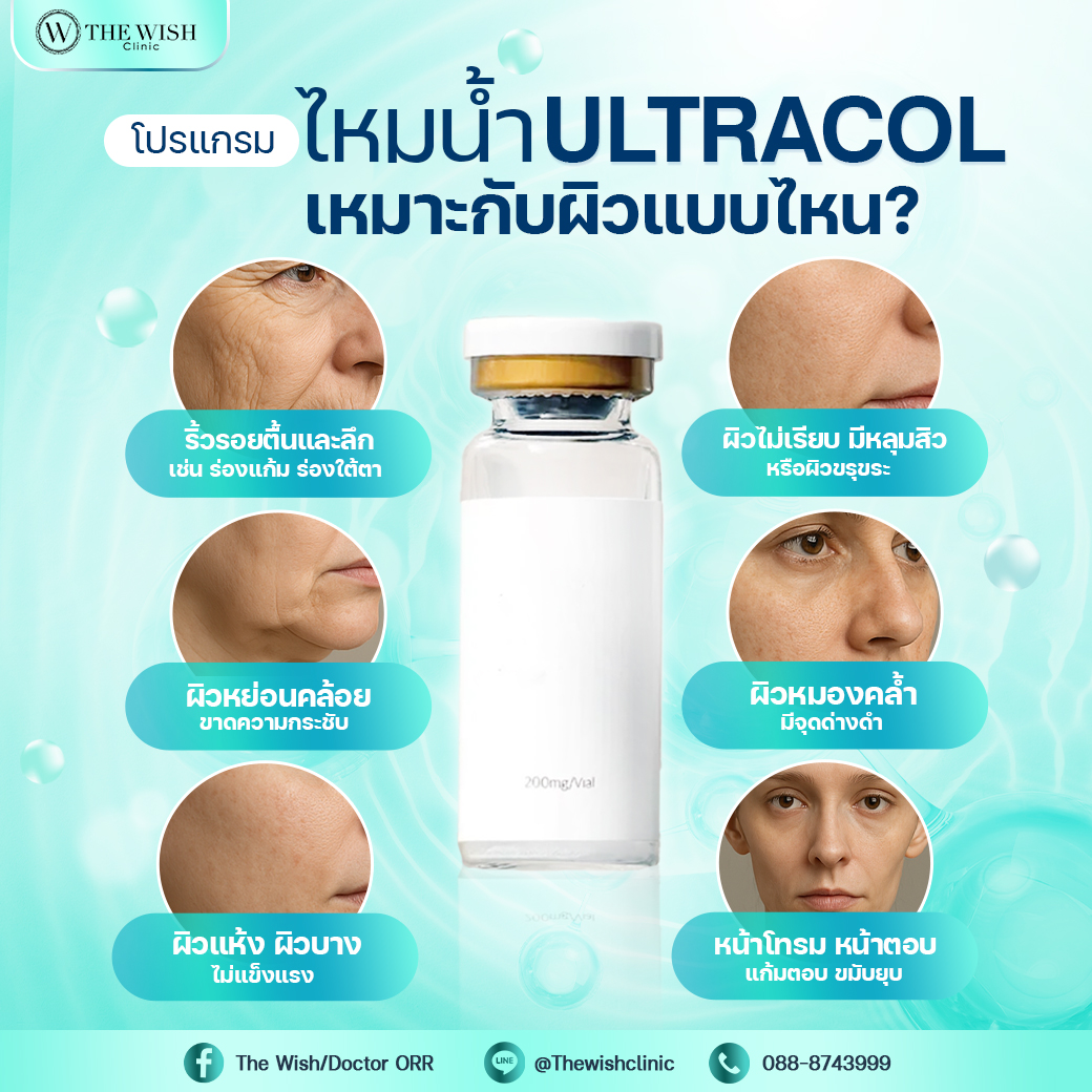 โปรแกรมไหมน้ำ Ultracol